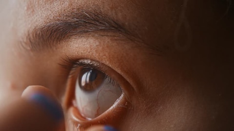 Insertion and Removal Techniques for your Ocular Prosthesis - Beryl ...