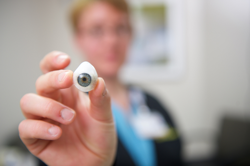 Custom Made Prosthetic Eye - Beryl Carvalho - Eyes Alive